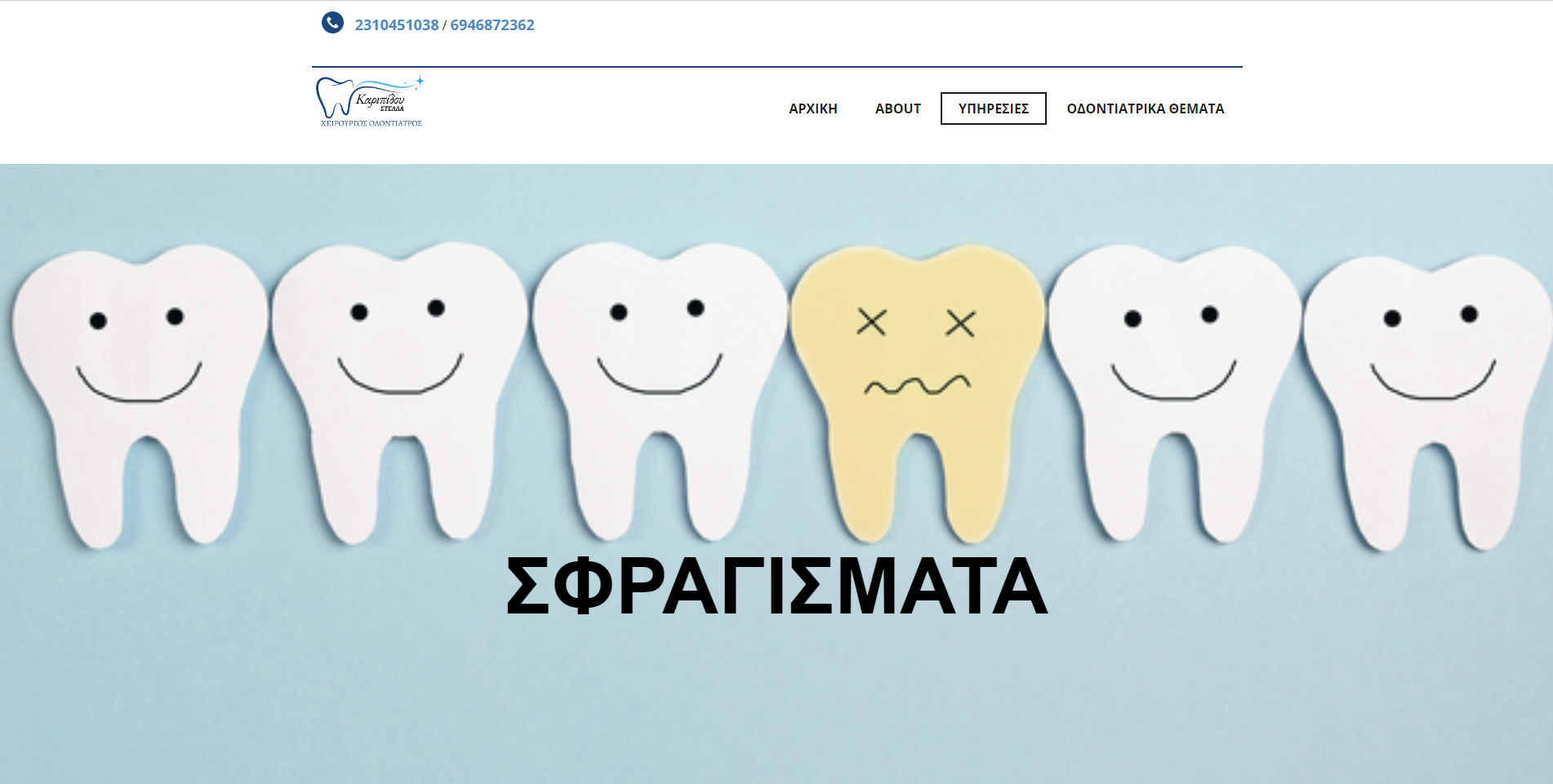 Σφραγίσματα | Χειρουργός Οδοντίατρος Καριπίδου Στέλλα