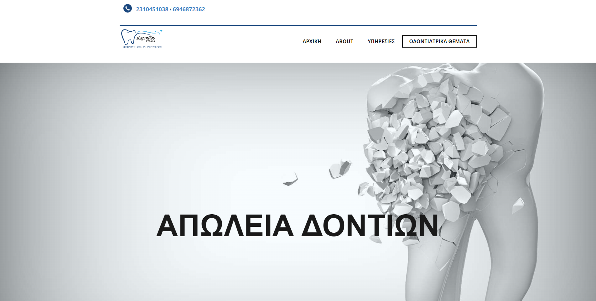 Απώλεια Δοντιών | Χειρουργός Οδοντίατρος Καριπίδου Στέλλα Καλαμαριά ...