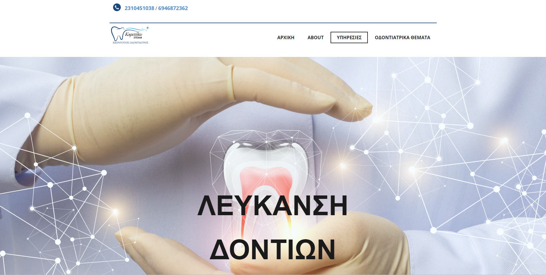 Λεύκανση Δοντιών | Χειρουργός Οδοντίατρος Καριπίδου Στέλλα